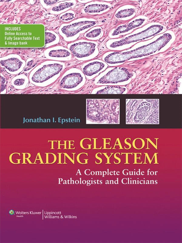 The Gleason Grading System by Epstein | Vasiliadis Medical Books