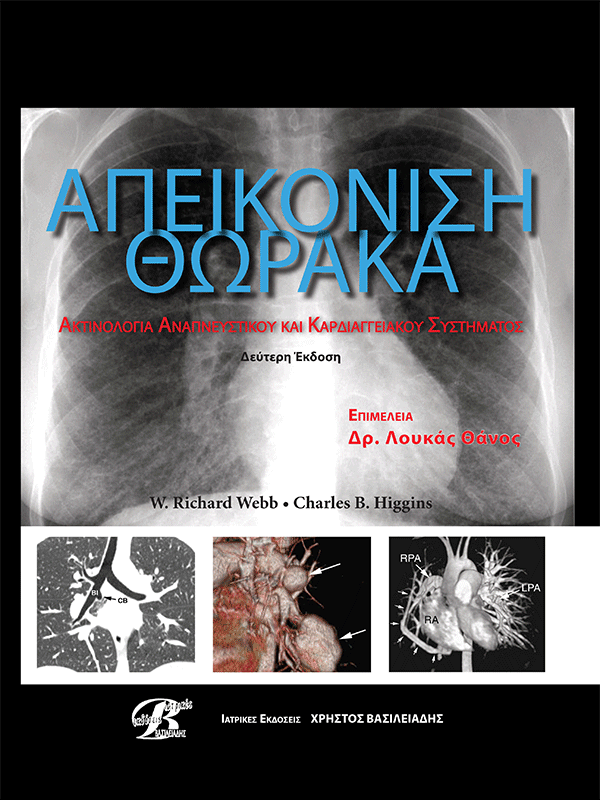 Απεικόνιση Θώρακα Webb: Ακτινολογία Αναπνευστικού και Καρδιαγγειακού ...