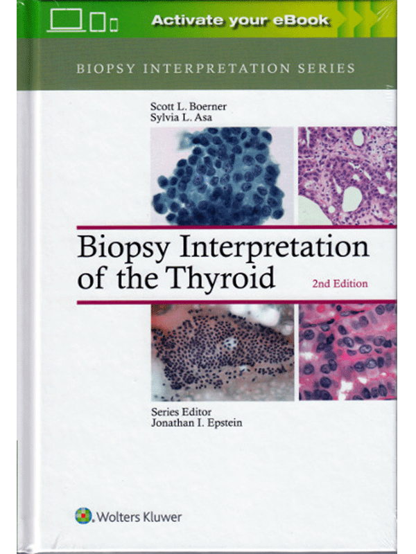 Biopsy Interpretation of the Thyroid, 2nd Edition | Vasiliadis Medical Books