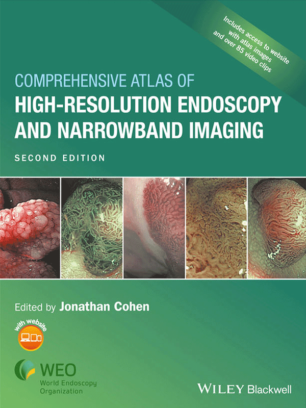 Comprehensive Atlas of High-Resolution Endoscopy and Narrowband Imaging ...