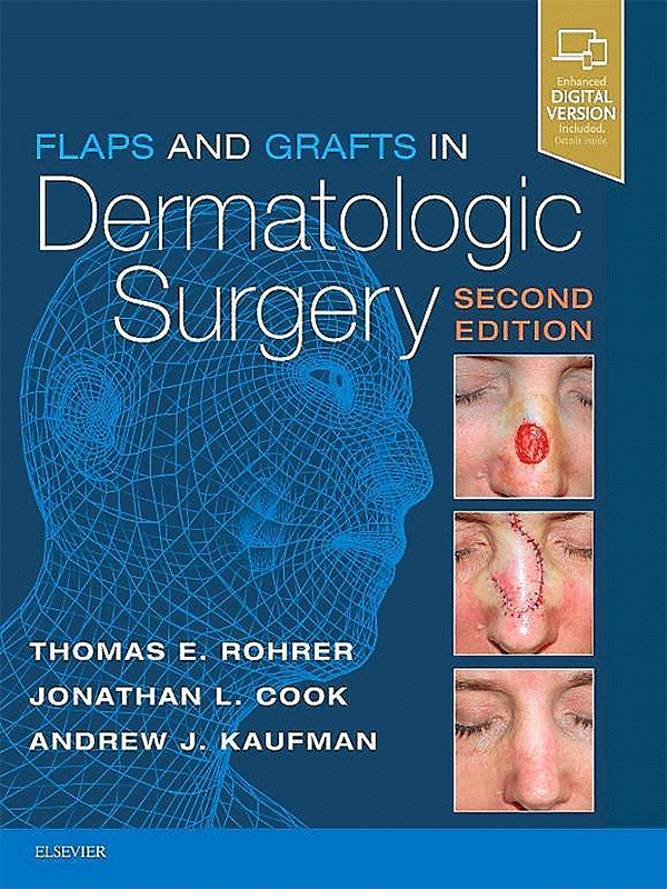 Flaps and Grafts in Dermatologic Surgery by Rohrer, 2nd Edition ...