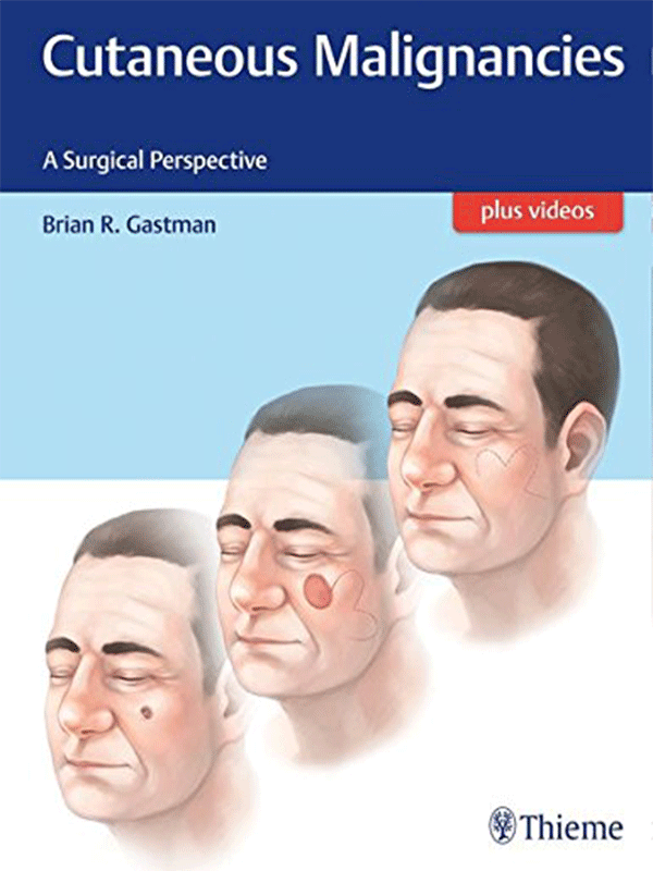 Cutaneous Malignancies: A Surgical Perspective | Vasiliadis Medical Books