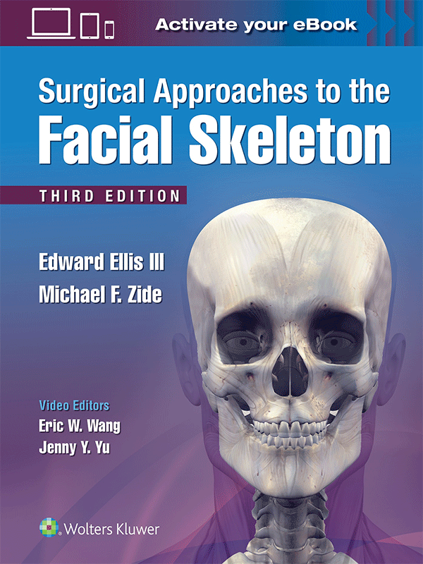 Surgical Approaches to the Facial Skeleton, 3rd Edition | Vasiliadis ...