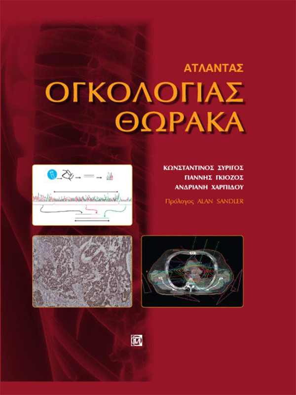 Άτλαντας Ογκολογίας Θώρακα | Vasiliadis Medical Books