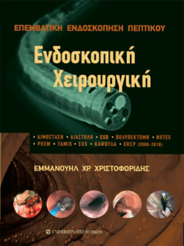 Ενδοσκοπική Χειρουργική: Επεμβατική Ενδοσκόπηση Πεπτικού | Vasiliadis ...