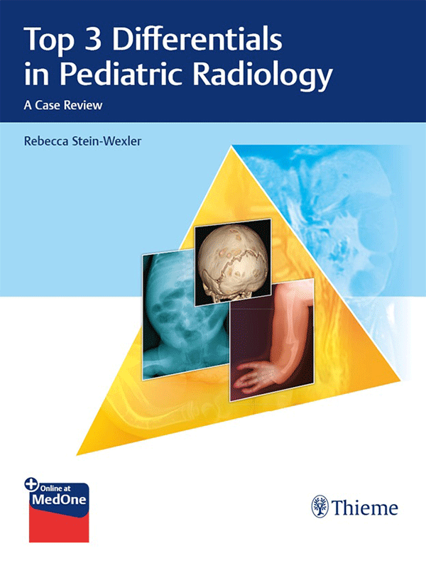 Top 3 Differentials in Pediatric Radiology: A Case Review | Vasiliadis ...