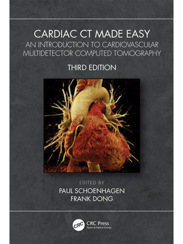 Cardiac CT Made Easy: An Introduction to Cardiovascular Multidetector ...