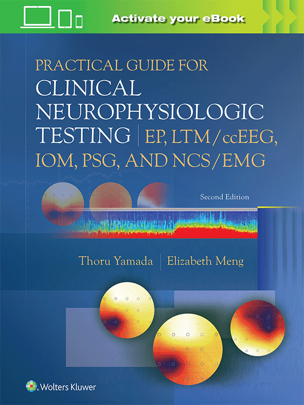 Practical Guide for Clinical Neurophysiologic Testing: EP, LTM/ccEEG ...