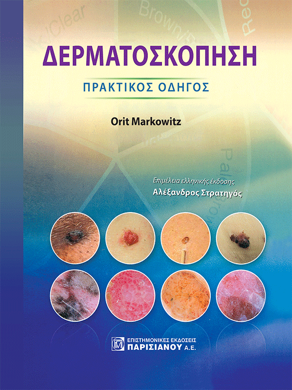 Δερματοσκόπηση Markowitz: Πρακτικός Οδηγός | Vasiliadis Medical Books