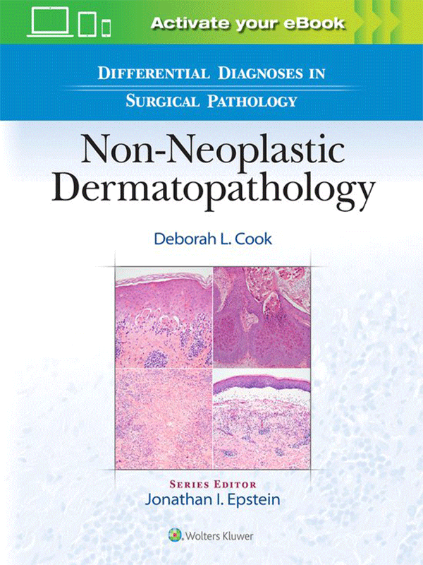 Differential Diagnoses in Surgical Pathology: Non-Neoplastic Dermatopathology | Vasiliadis ...