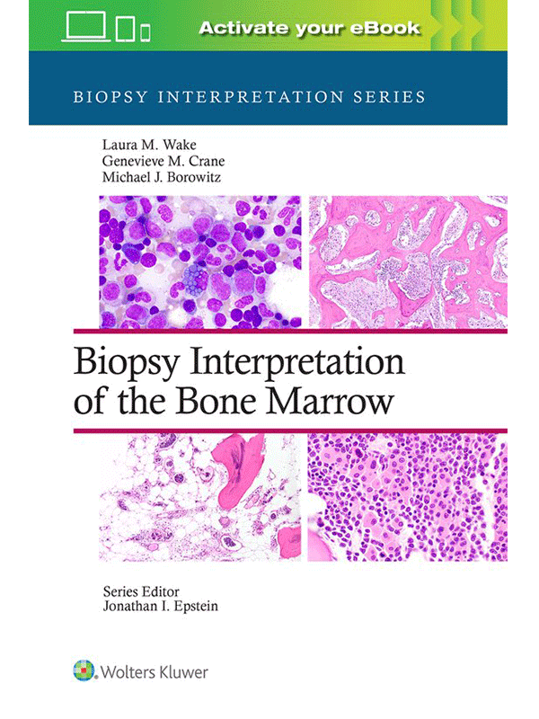 Biopsy Interpretation of the Bone Marrow | Vasiliadis Medical Books