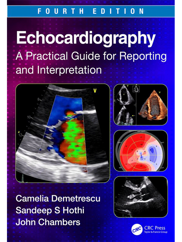 Echocardiography: A Practical Guide for Reporting and Interpretation ...