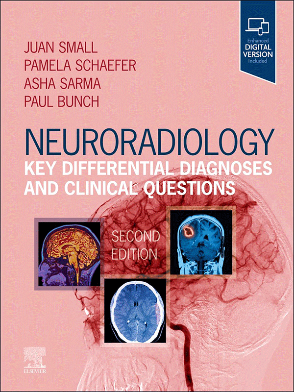 Neuroradiology: Key Differential Diagnoses and Clinical Questions, 2nd ...