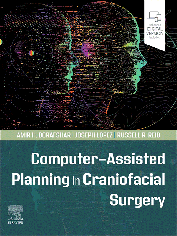 Computer-Assisted Planning in Craniofacial Surgery | Vasiliadis Medical ...