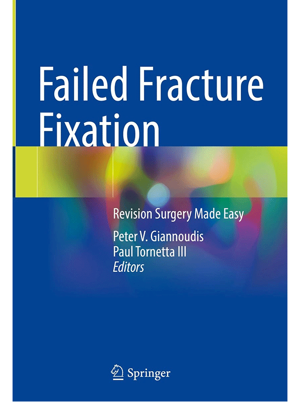 Failed Fracture Fixation: Revision Surgery Made Easy | Vasiliadis ...
