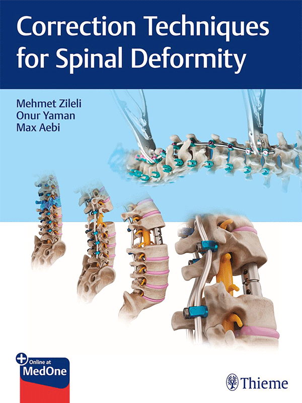 Correction Techniques for Spinal Deformity | Vasiliadis Medical Books
